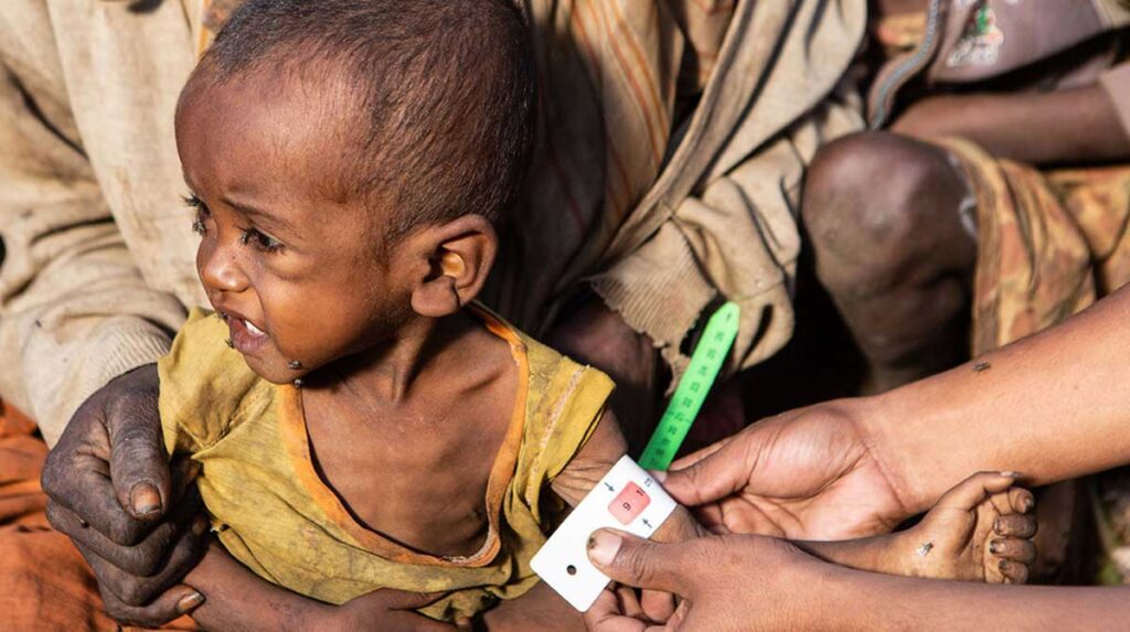 ‘Tsunami of hunger’ could trigger multiple famines – Geostrategic Media